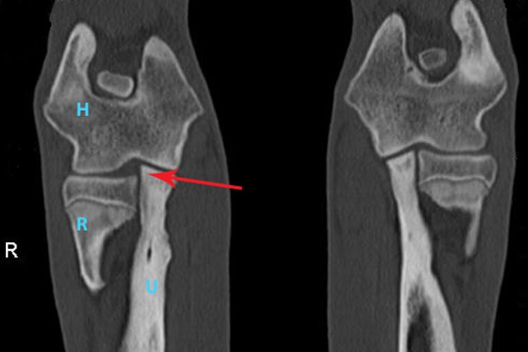 Ellbogendysplasie (ED) beim Hund - Tierklinik Sattledt