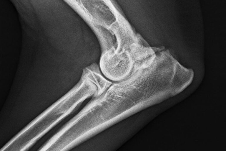 Ellbogendysplasie (ED) beim Hund - Tierklinik Sattledt